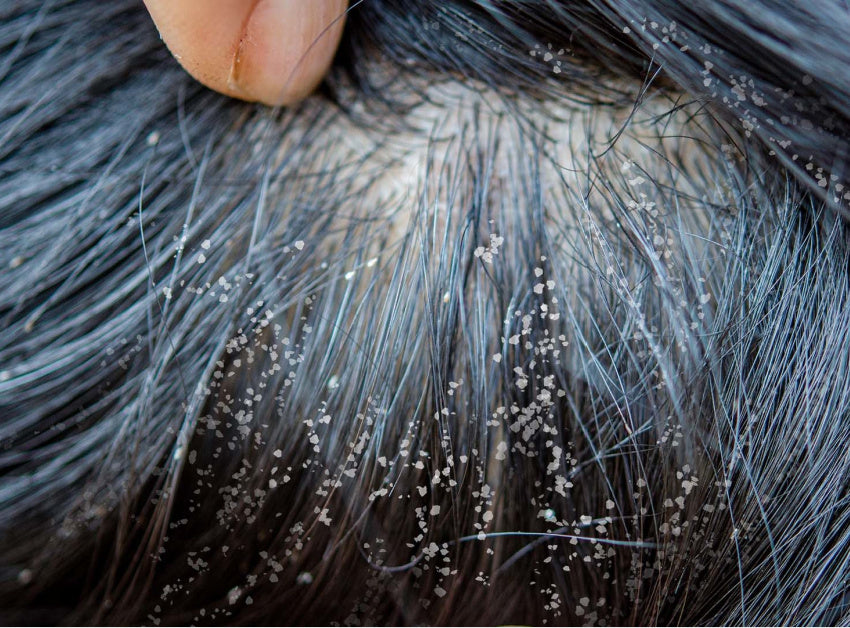 In-Home Lice Treatment Services | Professional Care That Comes to You ...